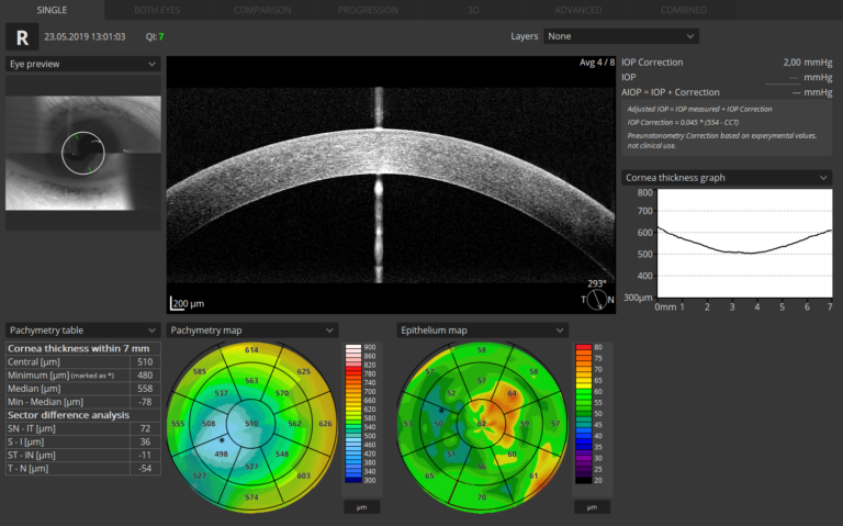 Optopol Spectral-Domain OCT Optopol REVO FC | Medoff