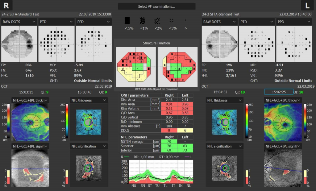 Optopol Spectral-Domain OCT Optopol REVO FC | Medoff